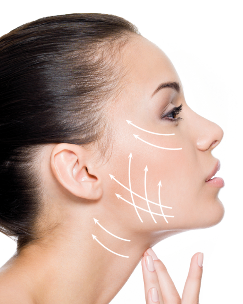 Threadlift - Anaya Aesthetics